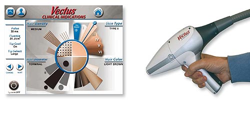 Espaço Sueli Nogueira: Vectus- Laser para pelos, última geração