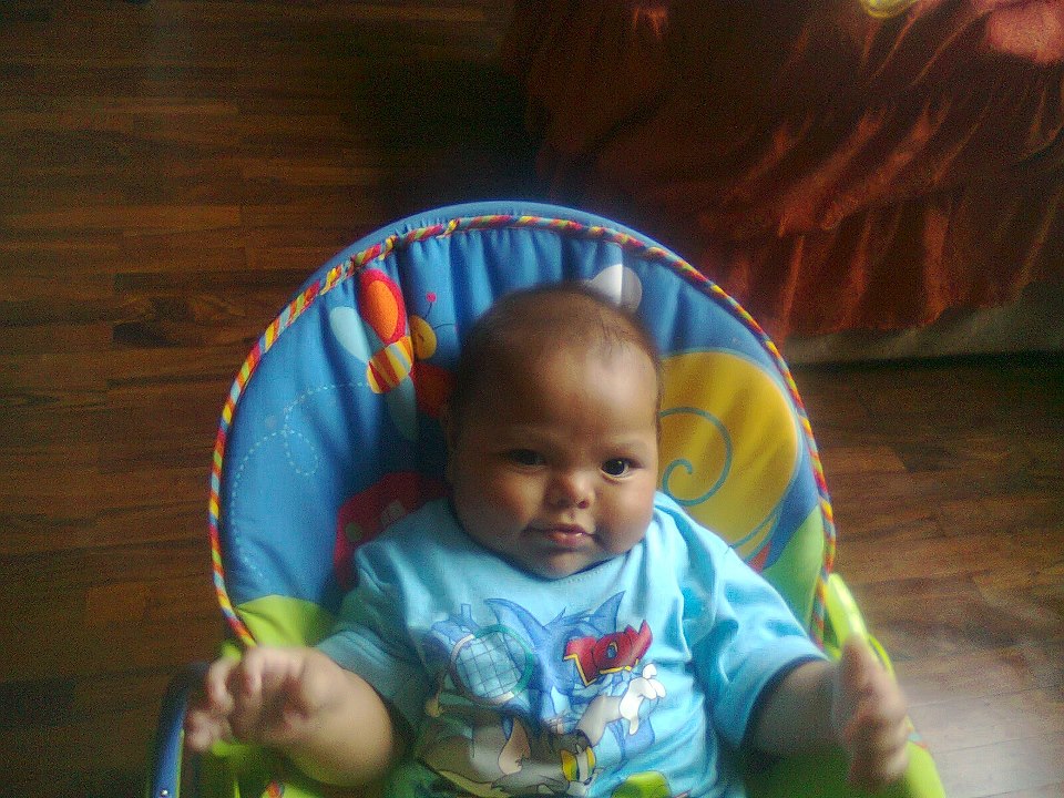 Pie Equino Varo - Pie Bot - Perú