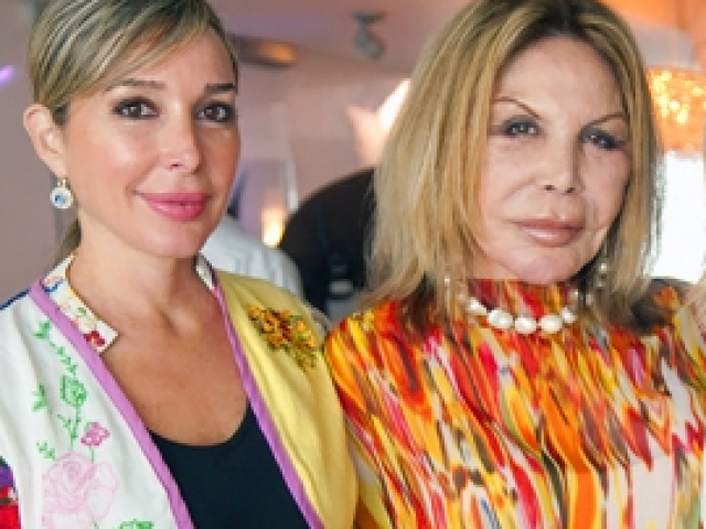 Elsa Patton Plastic Surgery Gone Wrong Before and After Facelift, Botox ...