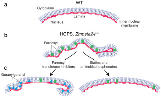 Progeria Disease Causes - The Mutation of lamin A