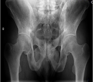 Tecnicos Radiologos: febrero 2014