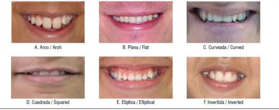HISTORIA DE LA ODONTOLOGIA: ANALISIS DE SONRISA
