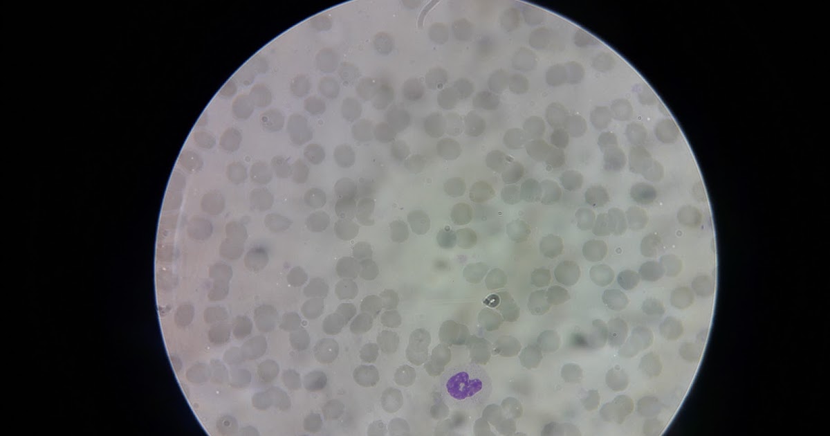 Ilmu Pengetahuan: DIFFERENTIAL COUNT WBC (HITUNG JENIS LEUKOSIT)