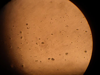 Medical Education for Students: Pathology Slides