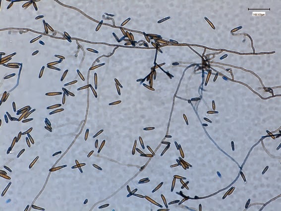 Fun With Microbiology (What's Buggin' You?): October 2013