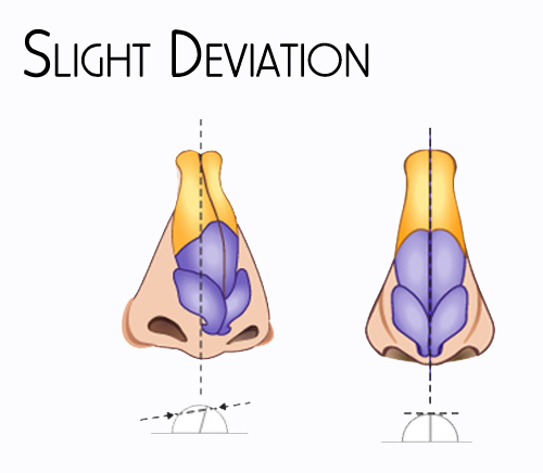 Eyelid Surgery Legend Dr. Kim Byung Gun: [BK Plastic Surgery Hospital ...