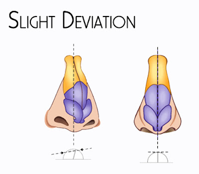 Eyelid Surgery Legend Dr. Kim Byung Gun: [BK Plastic Surgery Hospital ...