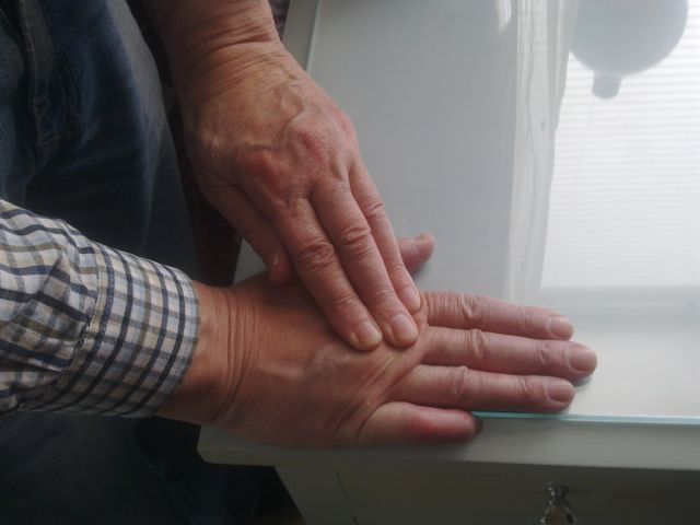 Handrehabilitationcase with Dupuytren's contracture.: A trauma in the ...