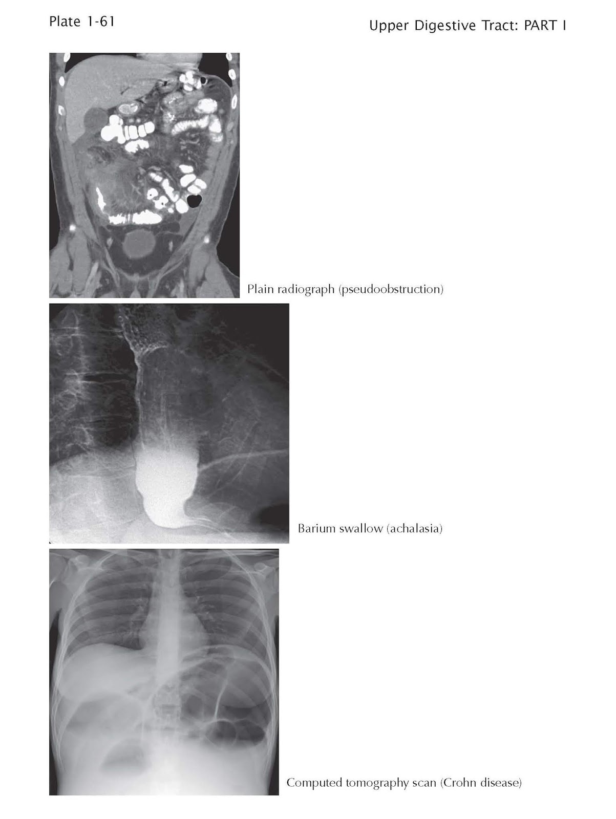 Overview of Imaging of the Upper Gastrointestinal Tract - pediagenosis