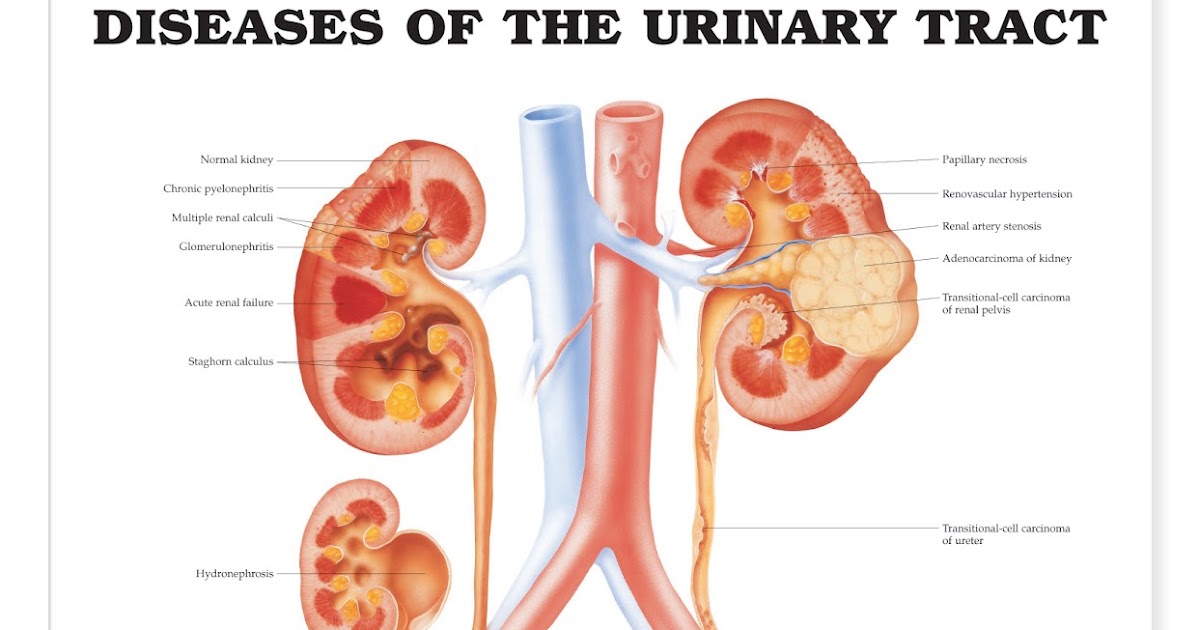 Diseases Of Genitourinary System ~ Urology Notes 2012
