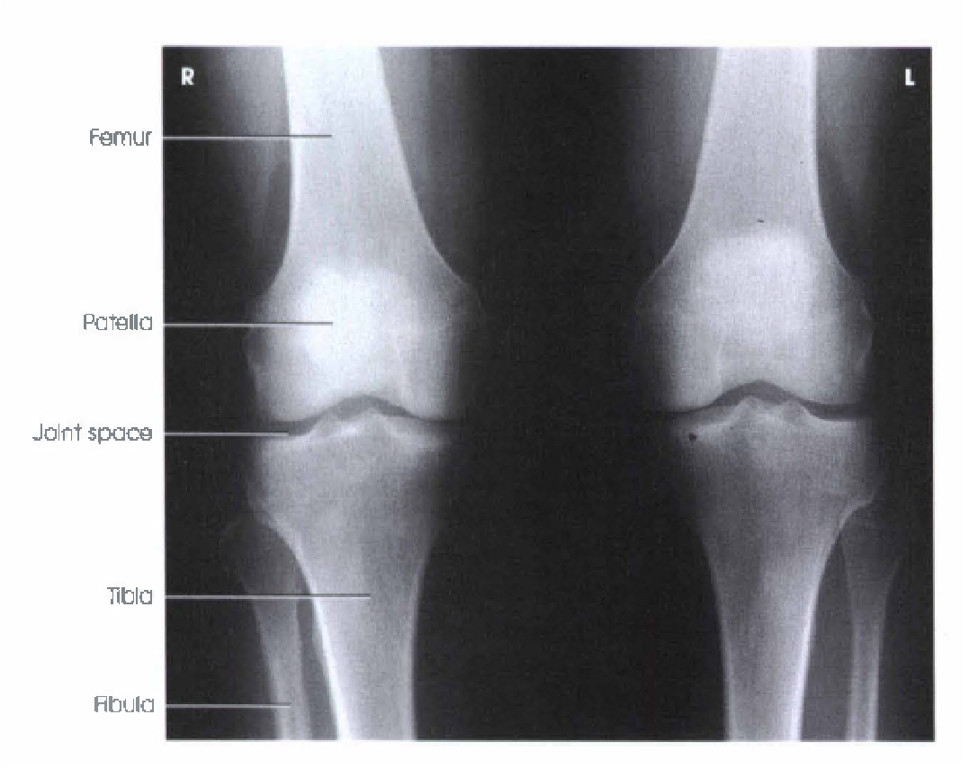 TEKNIK PEMERIKSAAN KNEE JOINT