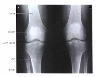 TEKNIK PEMERIKSAAN KNEE JOINT