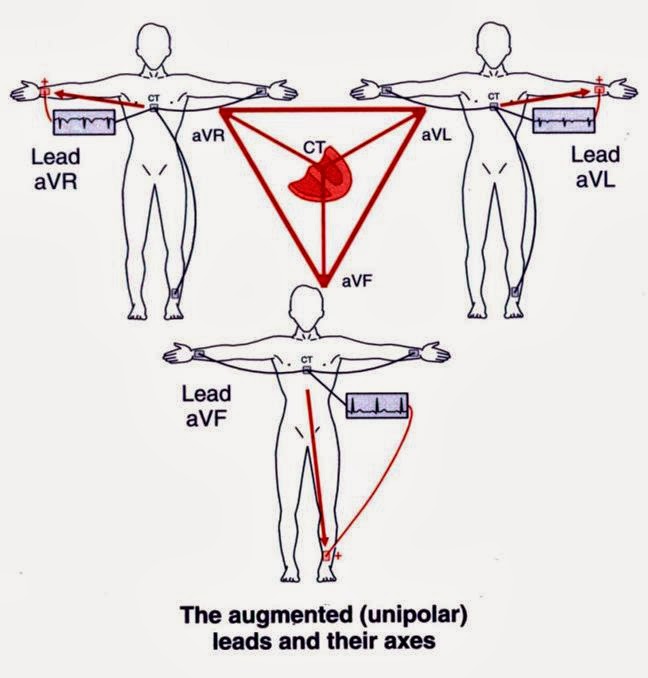 Elektrokardiografi (EKG) - dokter-medis