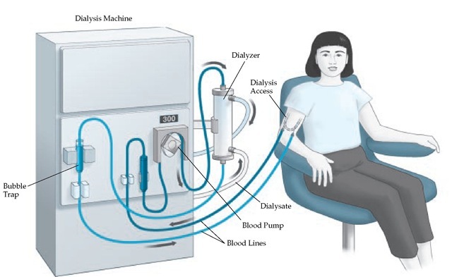 MY SCIENCE LABORATORY TECHNOLOGY: Dialysis as a biochemical procedure