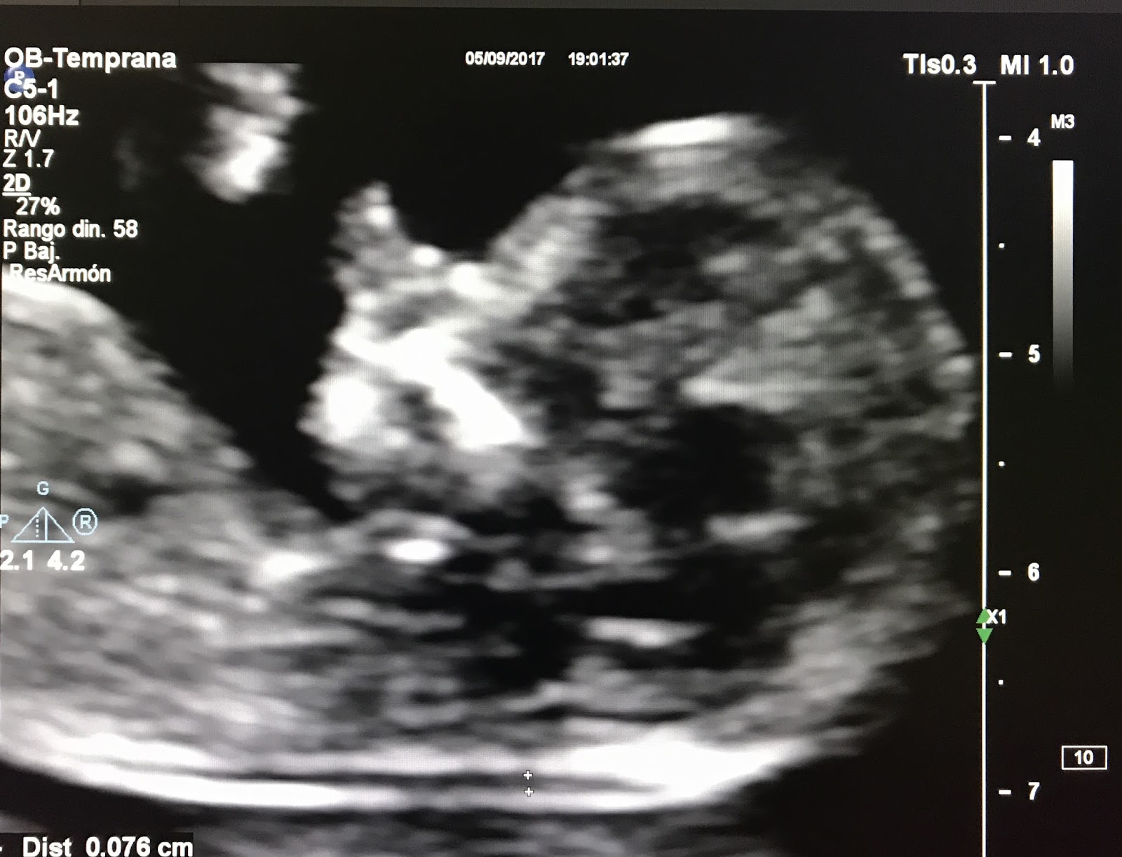 Donde puedo realizar la Traslucencia Nucal o NT plus?