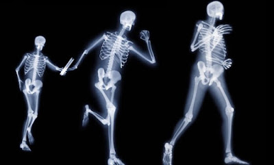 BONE diseases, emotional and spiritual meaning