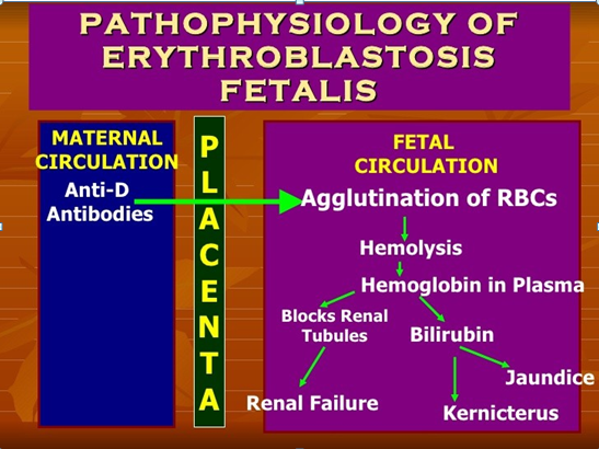 Erythroblastosis fetalis