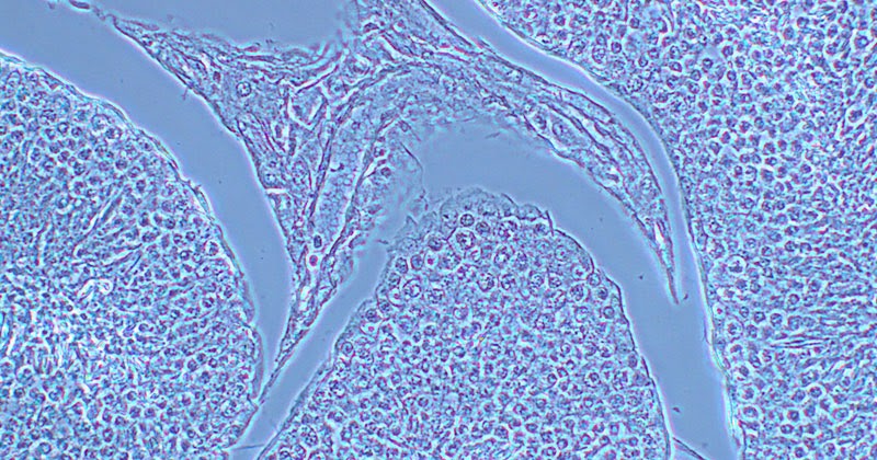 Motic Europe | Blog: The Phase contrast adjustment