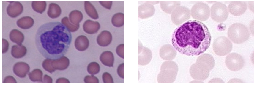 Curso Patologia B 2014