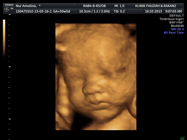 2D 3D 4D HD 5D scan ultrasound in MALAYSIA list : 5D 6D SCAN SONOVISION ...