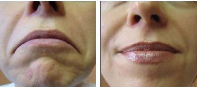 The Jade Lotus : Forget about Trout Pout - New Age Lips