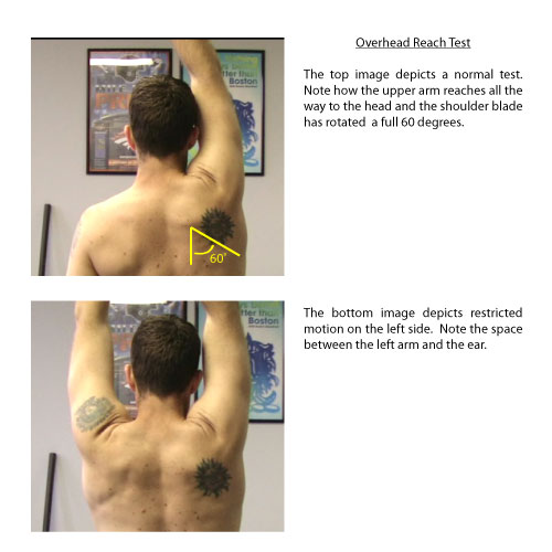 The Athletes Body: Testing Shoulder Mobility