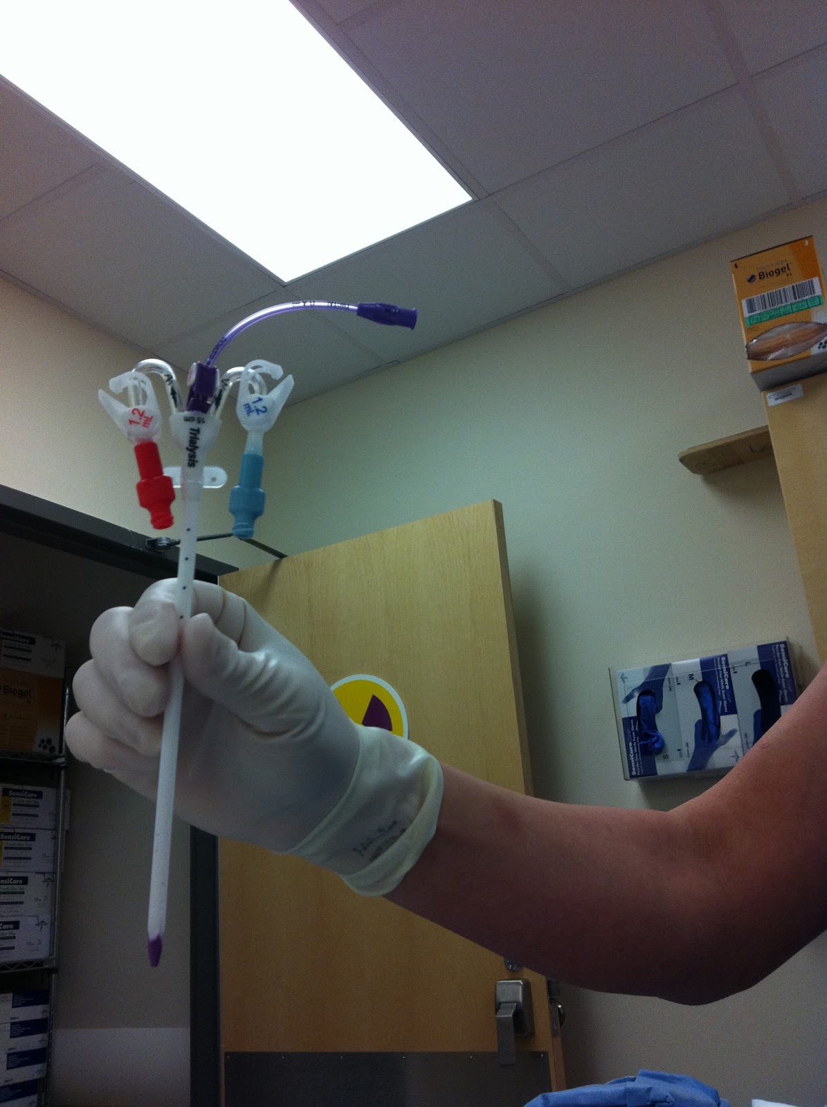 Quinton Line Insertion