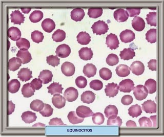 HEMATOLOGIA: EQUINOCITO
