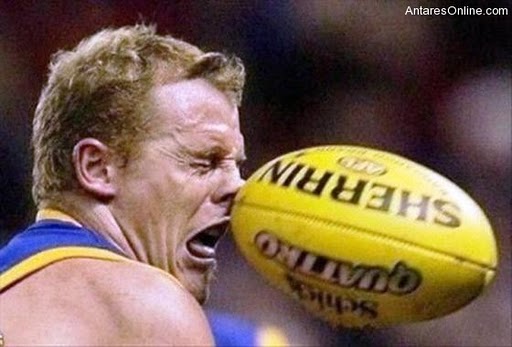 VIRAL PHOTOS: ATHLETES AWFUL FUNNY MOMENTS: Rugby - Athletes Most Awful ...