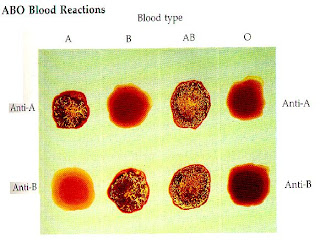 Aroldo Filho ... Biomedicina: AGLUTINAÇÃO SANGUINEA