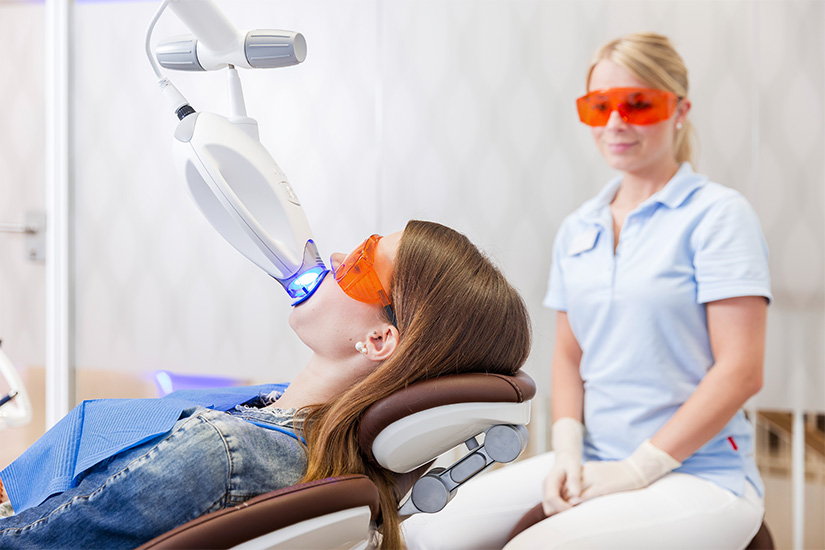 Mydentalsharing: „In-office-Bleaching“: Strahlende Zähne in nur einer ...