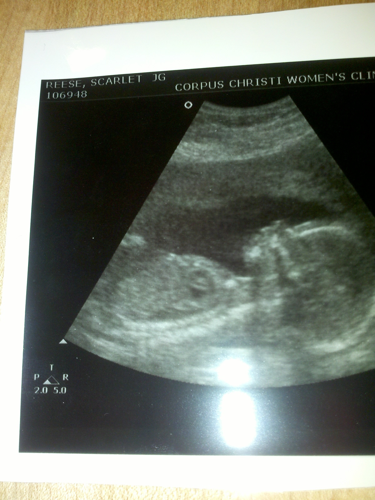 Kevin and Scarlet's Journey: 19 week ultrasound and first belly pic