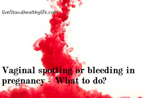 Vaginal spotting or bleeding in pregnancy - What to do?