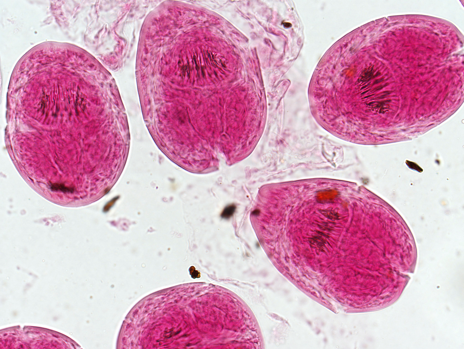 Creepy Dreadful Wonderful Parasites: 2016