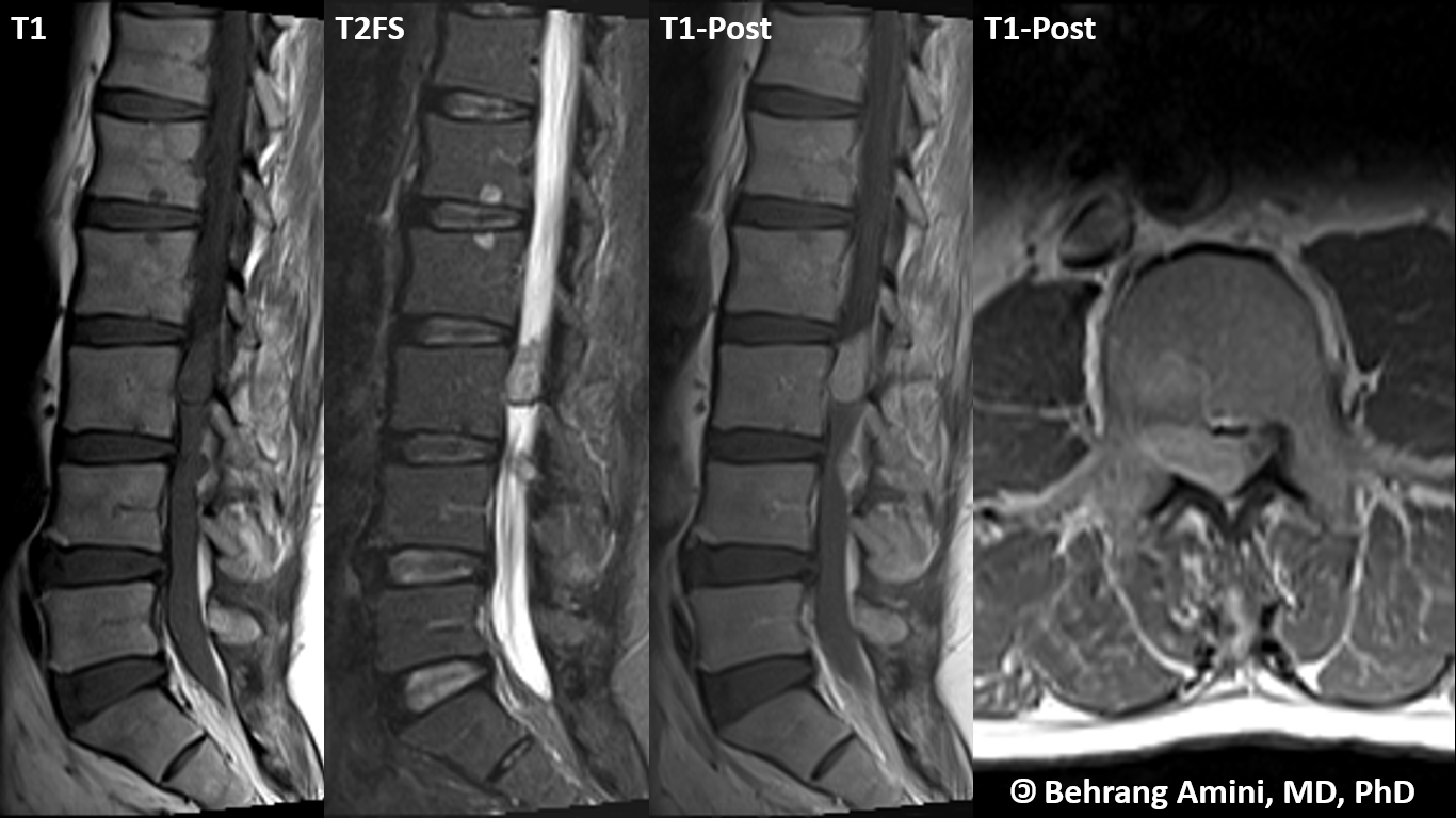 Roentgen Ray Reader: July 2017