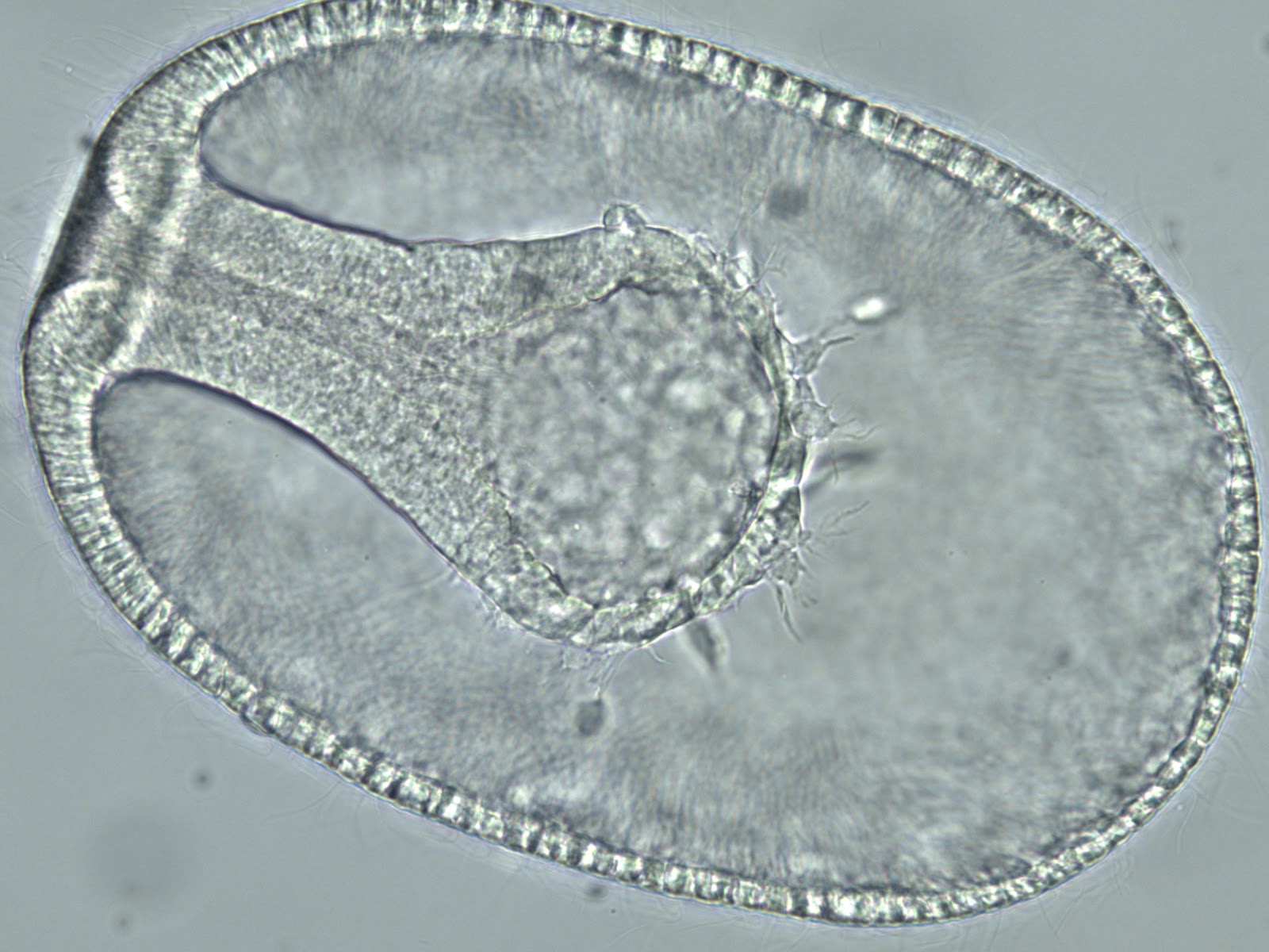 Invertebrate Embryology: Filopodia of mesenchymal cells in gastrulating ...