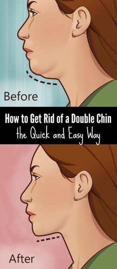 How To Get Rid Of A Double Chin The Quick And Easy Way HEALTHYLIFE how-to-get-rid-of-a-double-chin-the-quick-and-easy-way-healthylife