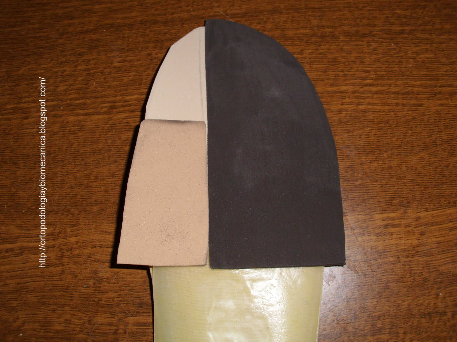 Ortopodologia y Biomecanica : HALLUX LIMITUS FUNCIONAL Y KINETIC WEDGE