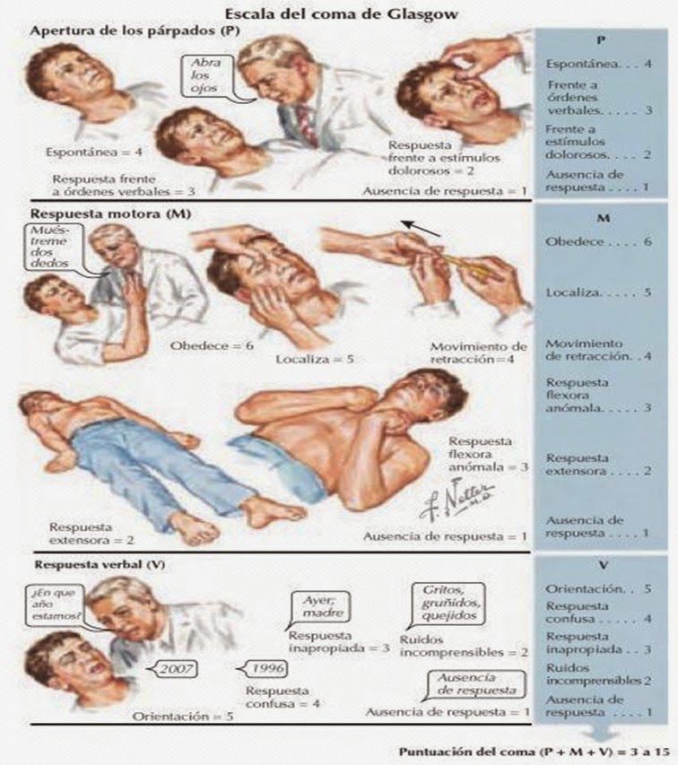 A LUZ DA ENFERMAGEM : Escala de Glasgow
