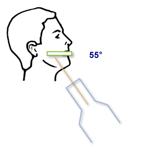 Dentistry and Medicine: Intraoral Radiographic Techniques (Intraoral ...