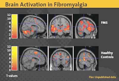 The Shaman Papers: Jung - healing journals and soul building