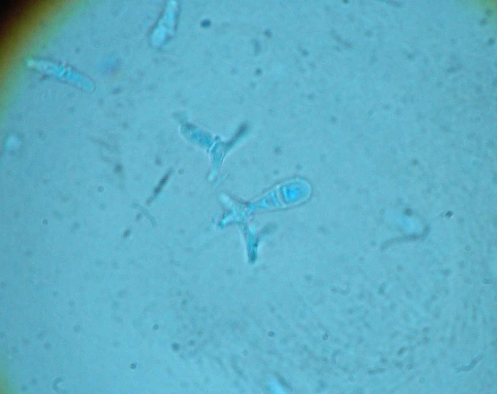 ATLAS MICOLOGIA: EPIDERMOPHYTON FLOCCOSUM