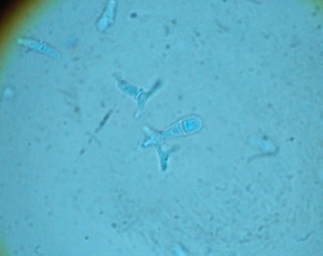 ATLAS MICOLOGIA: EPIDERMOPHYTON FLOCCOSUM
