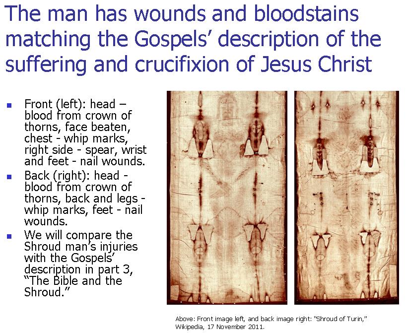 The Shroud of Turin: Shroud of Turin: Burial sheet of Jesus!: #9 The ...