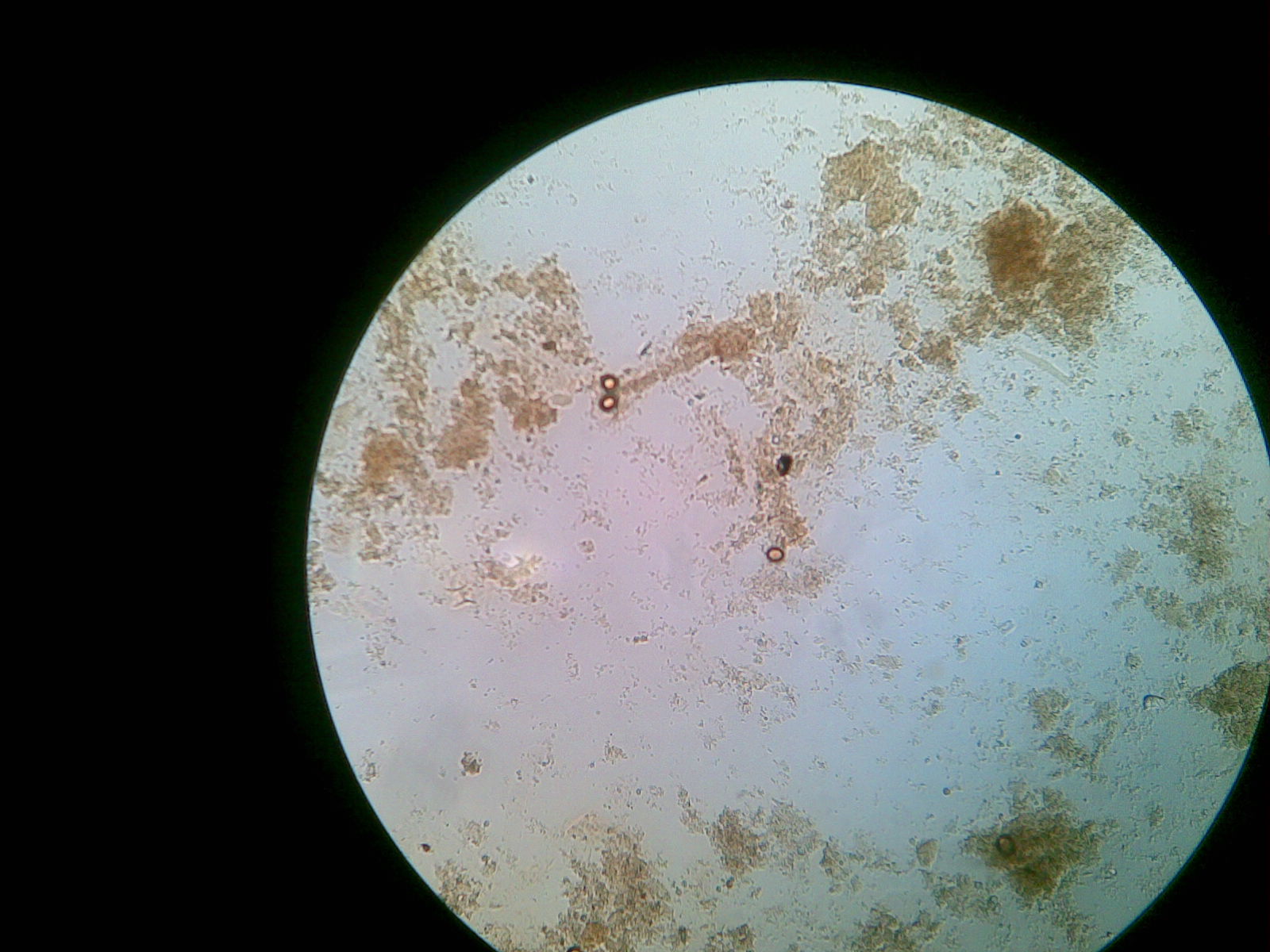 Ca - CaDo (Catatan Calon Dokter): Blok 9 : Praktikum Parasitologi ...