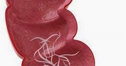 prirodno lecenje biljem