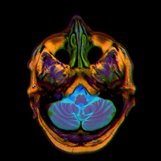 Nevit's blog: Color MRI of the Brain