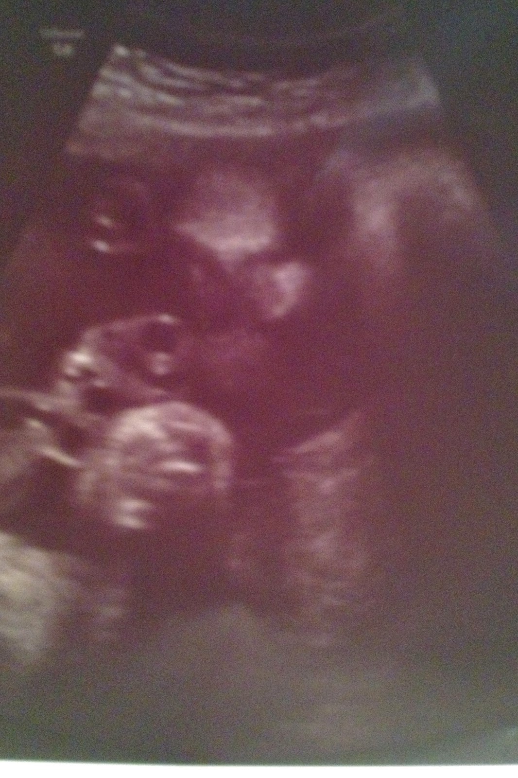 Our Little Baby: Pregnancy Updates: 35 Weeks