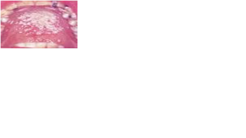 Kinywa, meno na afya yako: Yajue Baadhi ya Magonjwa Yenye Uhusiano ...