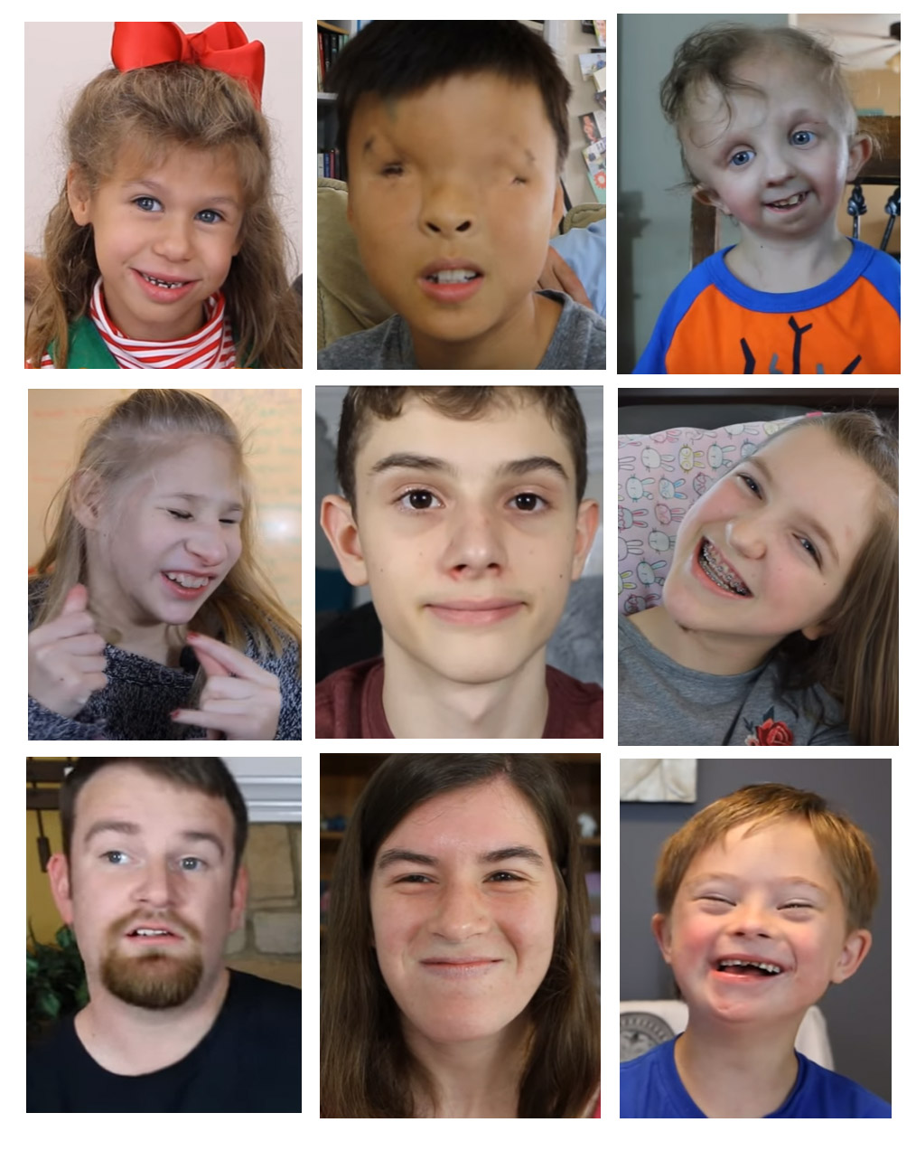 Special People: Why Listening to the Disabled is One Way to Combat ...